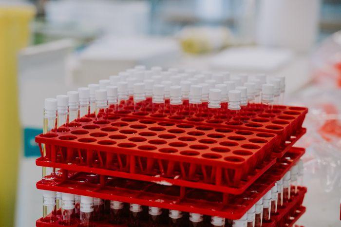 Key findings of EY’s annual Biotech Beyond Borders Report 2025 | The ...