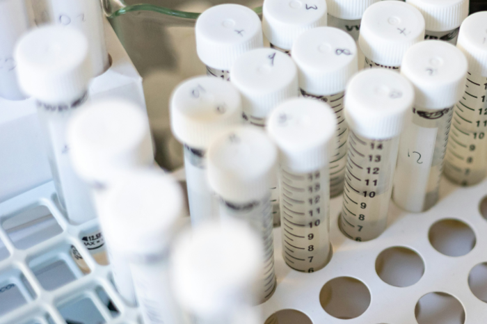 Arcus pulls another TIGIT trial as Gilead steps back | Biotechnology ...